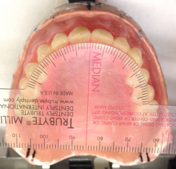 Setting anatomical teeth | Mouthing Off | Blog of the American Student ...